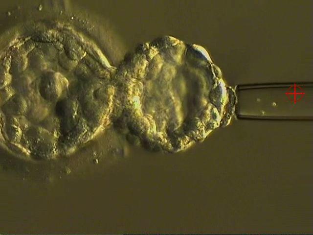 A new test for IVF embryos | New Zealand Geographic