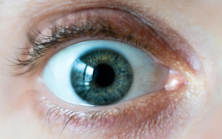 It's in your eyes: pupil size a marker of intelligence | New Zealand ...