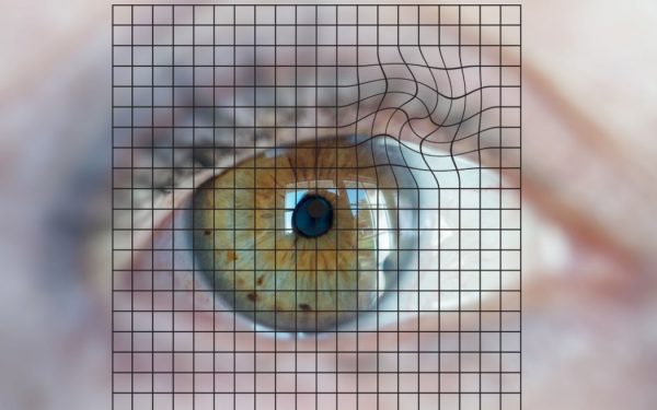 New technology developed for eye disease early detection | New Zealand ...